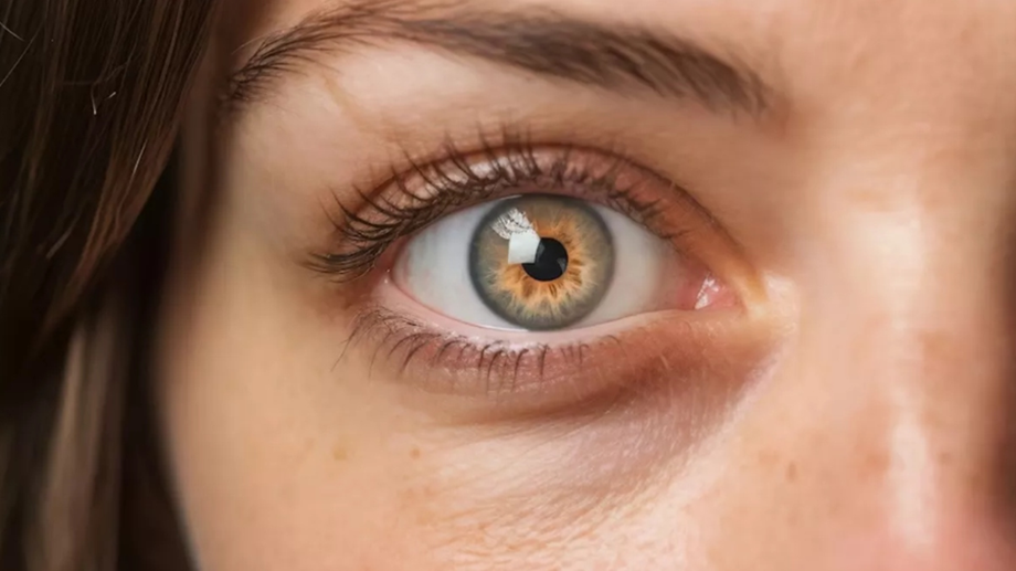 Eye Health: High blood pressure or blood sugar can cause vision loss ...